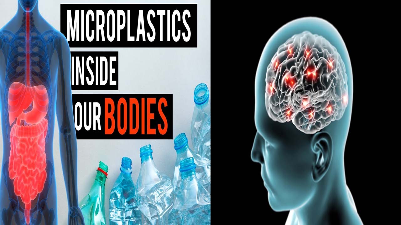 सावधान! ब्रेन तक में घुसा हुआ है प्लास्टिक | Plastic In Human Body ...