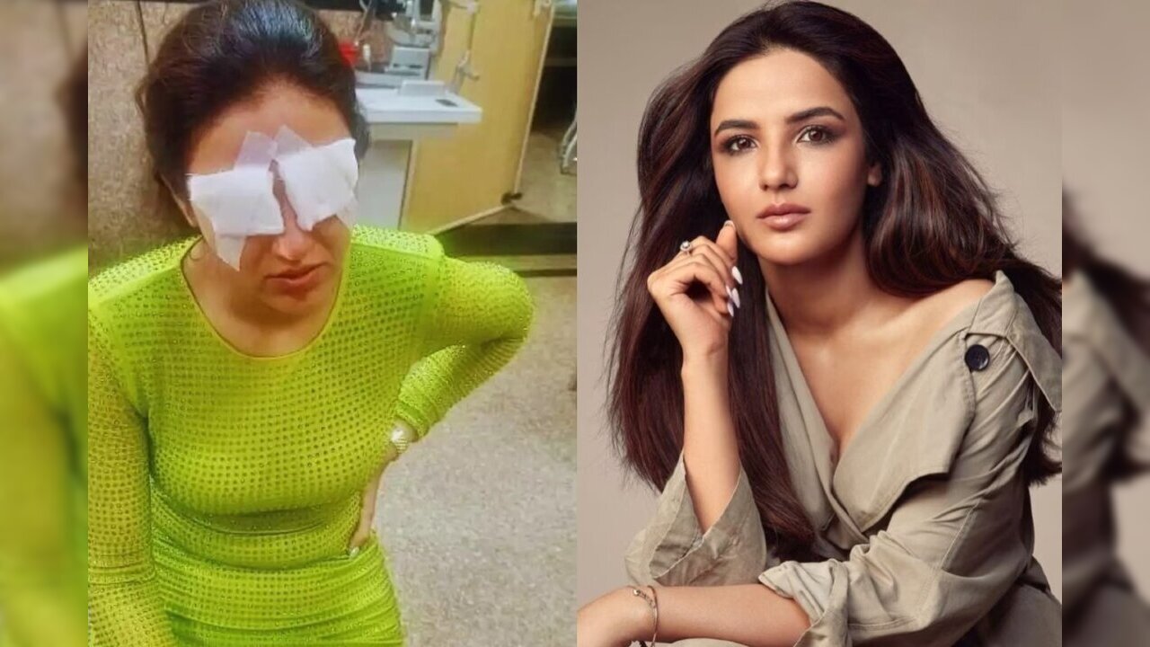 Contact Lenses Side Effects| Contact Lenses Ke Nuksan| Contact Lenses ...