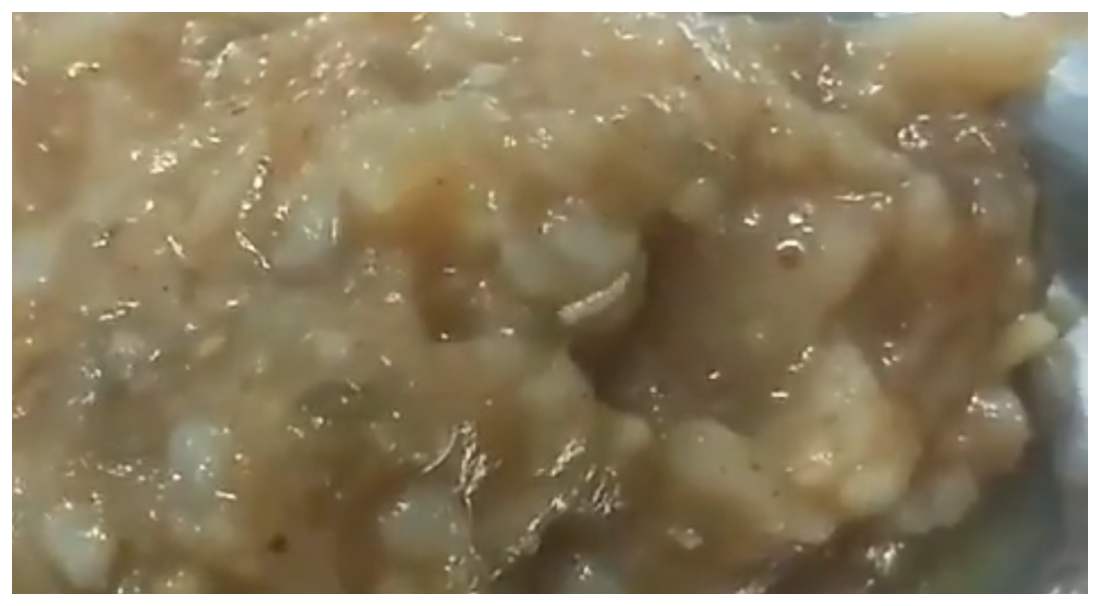 Lucknow News | BBAU | Hostel | Food | छात्र के खाने में निकला कीड़ा ...