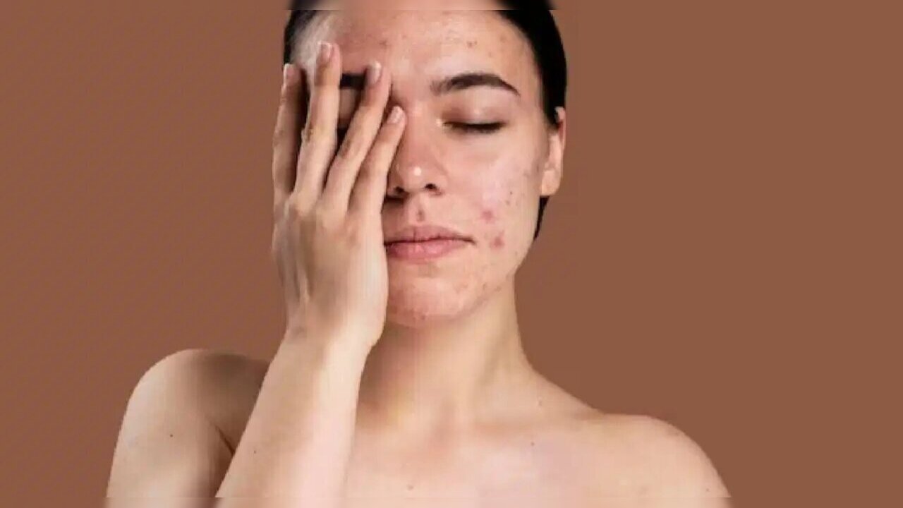 Skin Care Tips To Protect Your Skin From Air Pollution| Pradushan Se ...