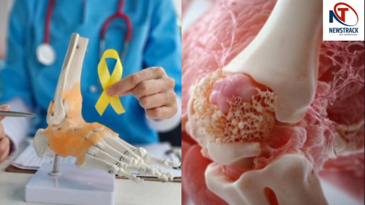 Bone Marrow Cancer| Bone Marrow Cancer symptoms| Causes of bone marrow ...