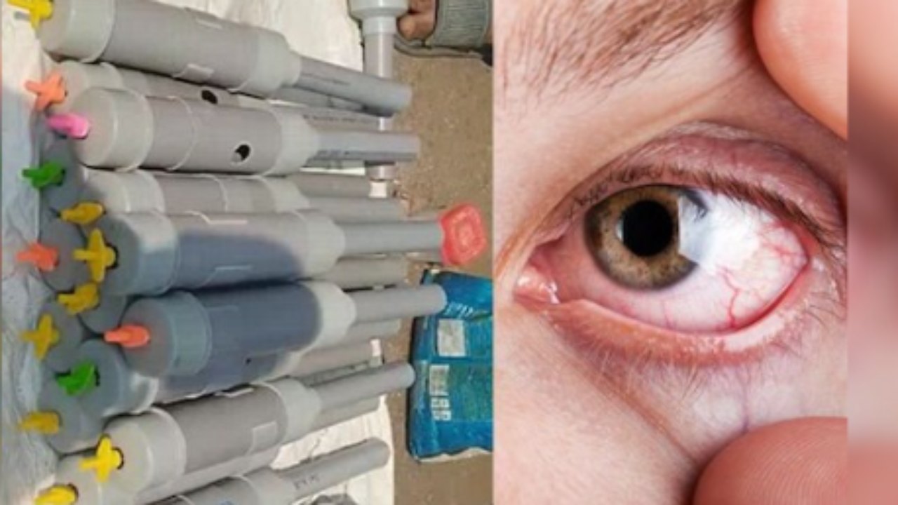 Carbine Gun| Plastic Carbine Gun|Children Lose Eyesight|Eye Injury ...