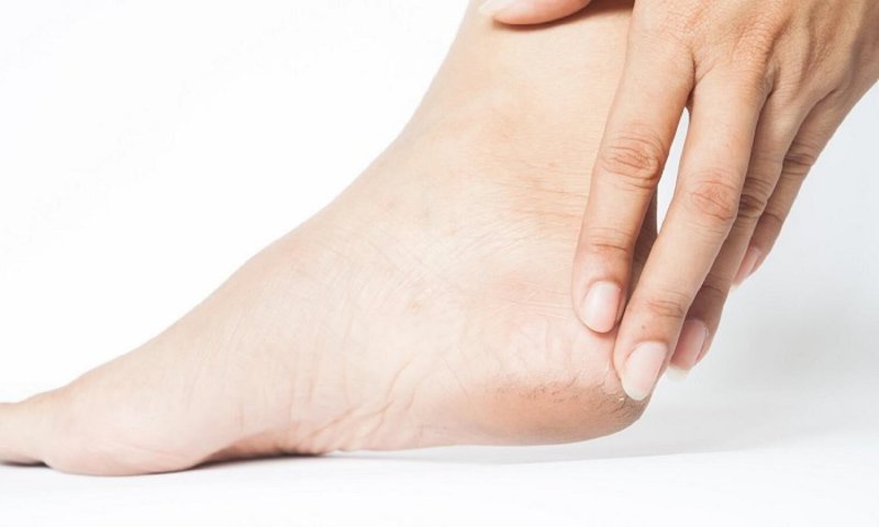 Pair ki edi ka fatna : फटी एड़ियों से पाना है छुटकारा तो अपनाएं यह ...